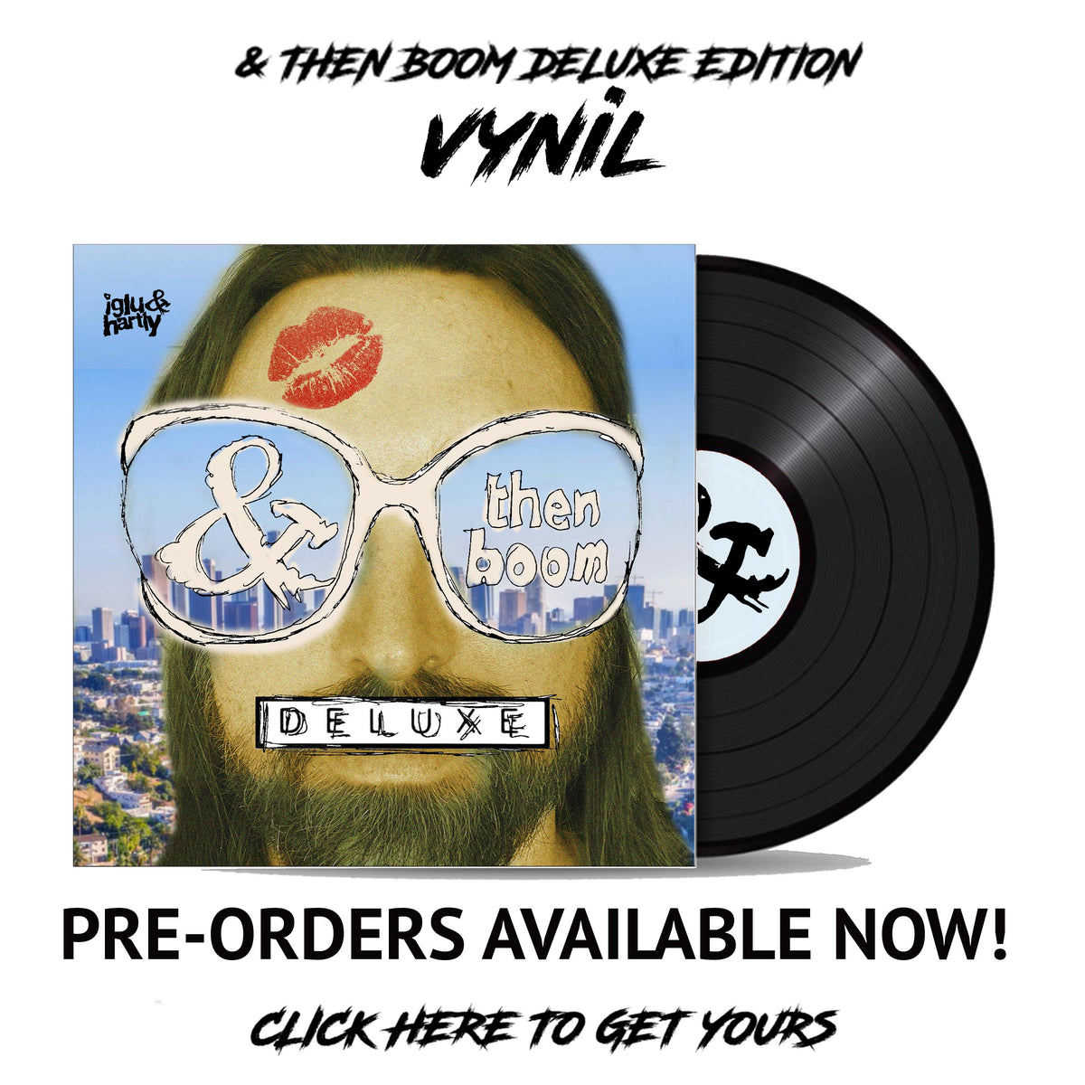 & Then Boom [DELUXE] VINYL – Iglu & Hartly